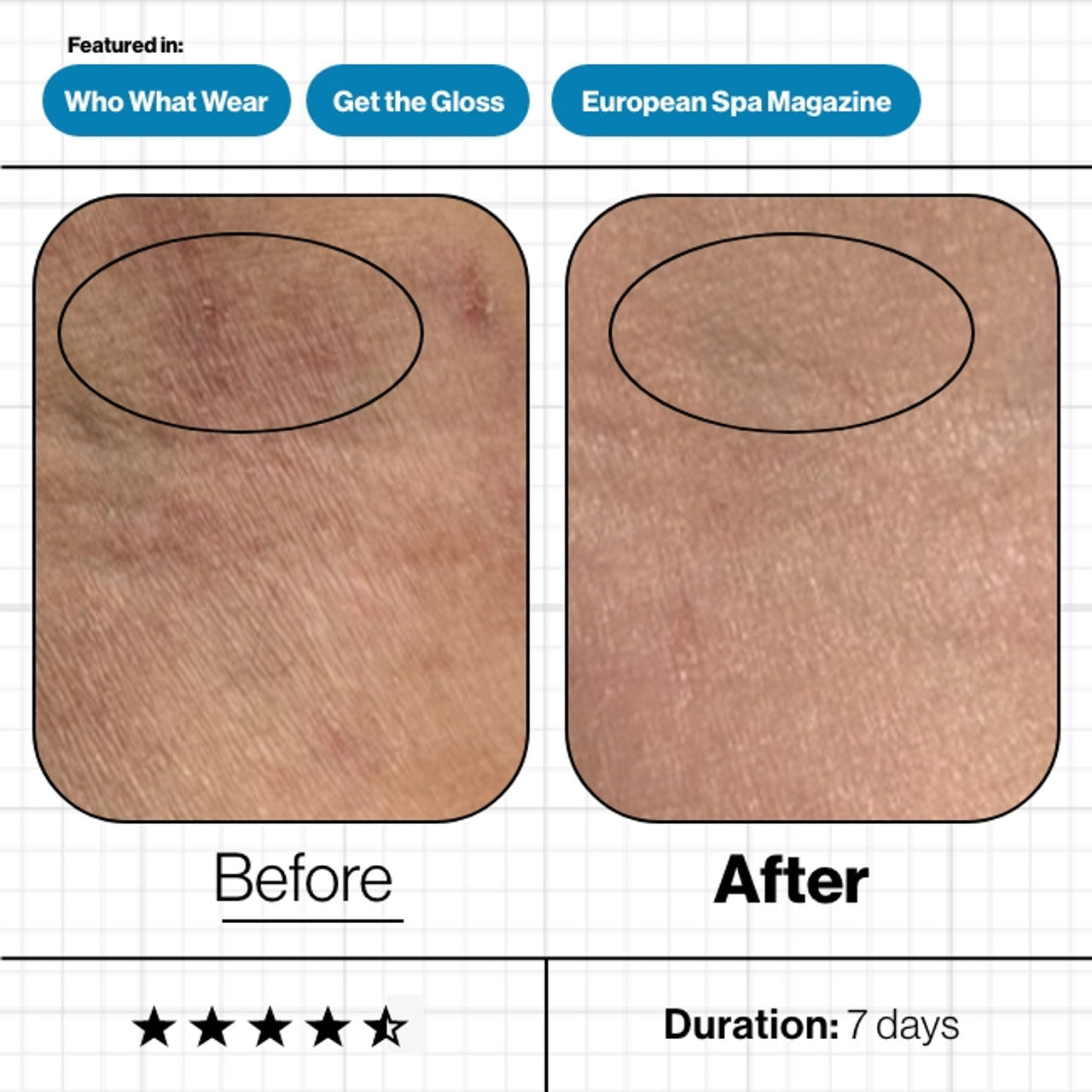 Skin Moisture IQ – Dermaly Shop